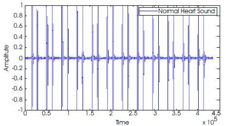 Figure 1. Normal heart sound(NHS)