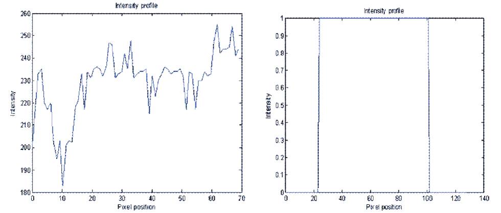 Figure 9. Intensity Profile across tumor, Pre and Post Segmentation