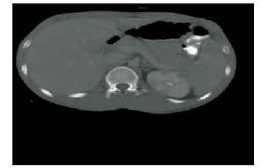 Figure 3. Input CT scan image of the infected organ