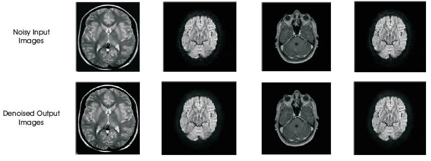 Figure 3. 10 Different Sets of Noisy MRI Images acquired from the MRI ...